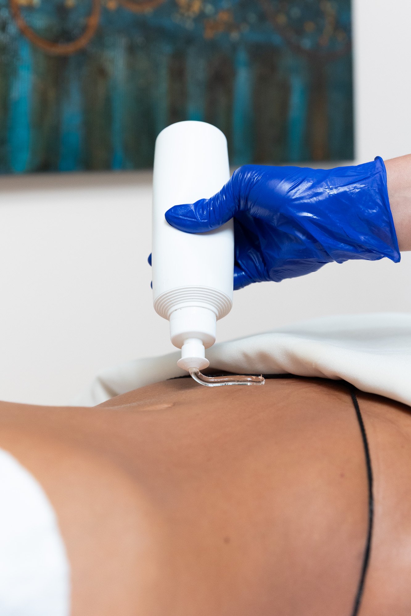 RF Skin Tightening in Vienna | EMA&W